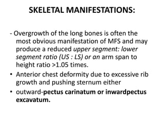4.marfansyndrome | PPTX