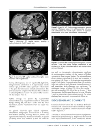 Rupture of a Hydatid Cyst into the Bile Duct | PDF