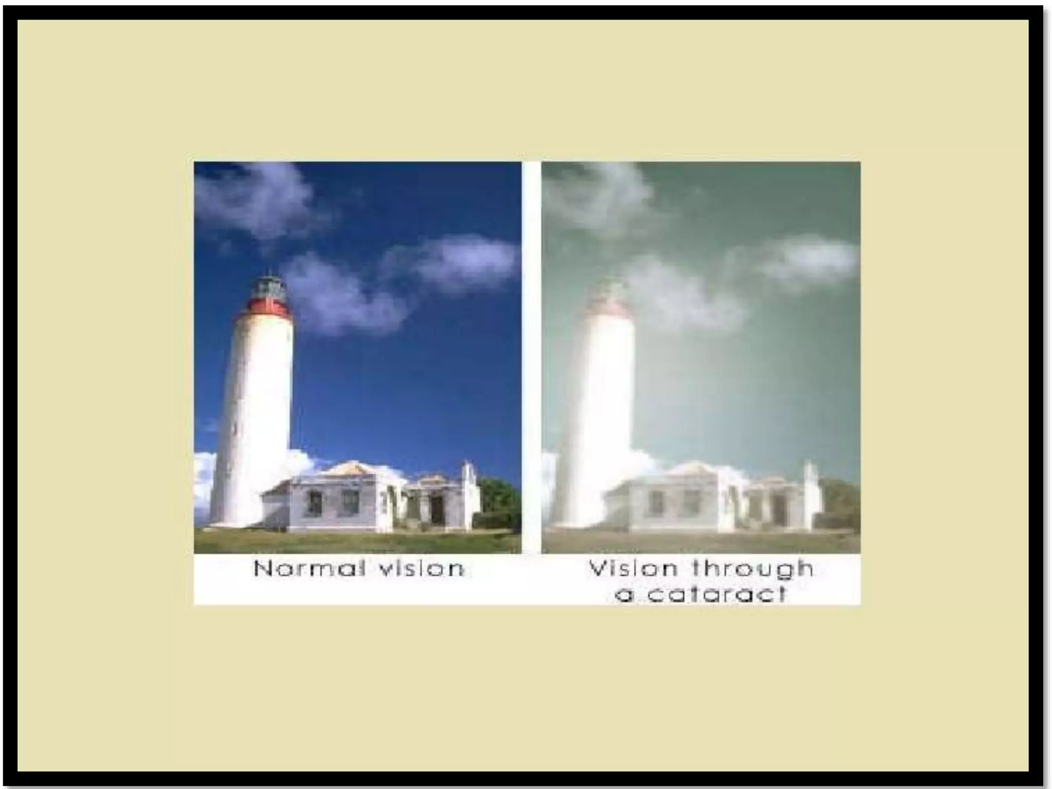 4. unit ii tm visual impairment | PPT