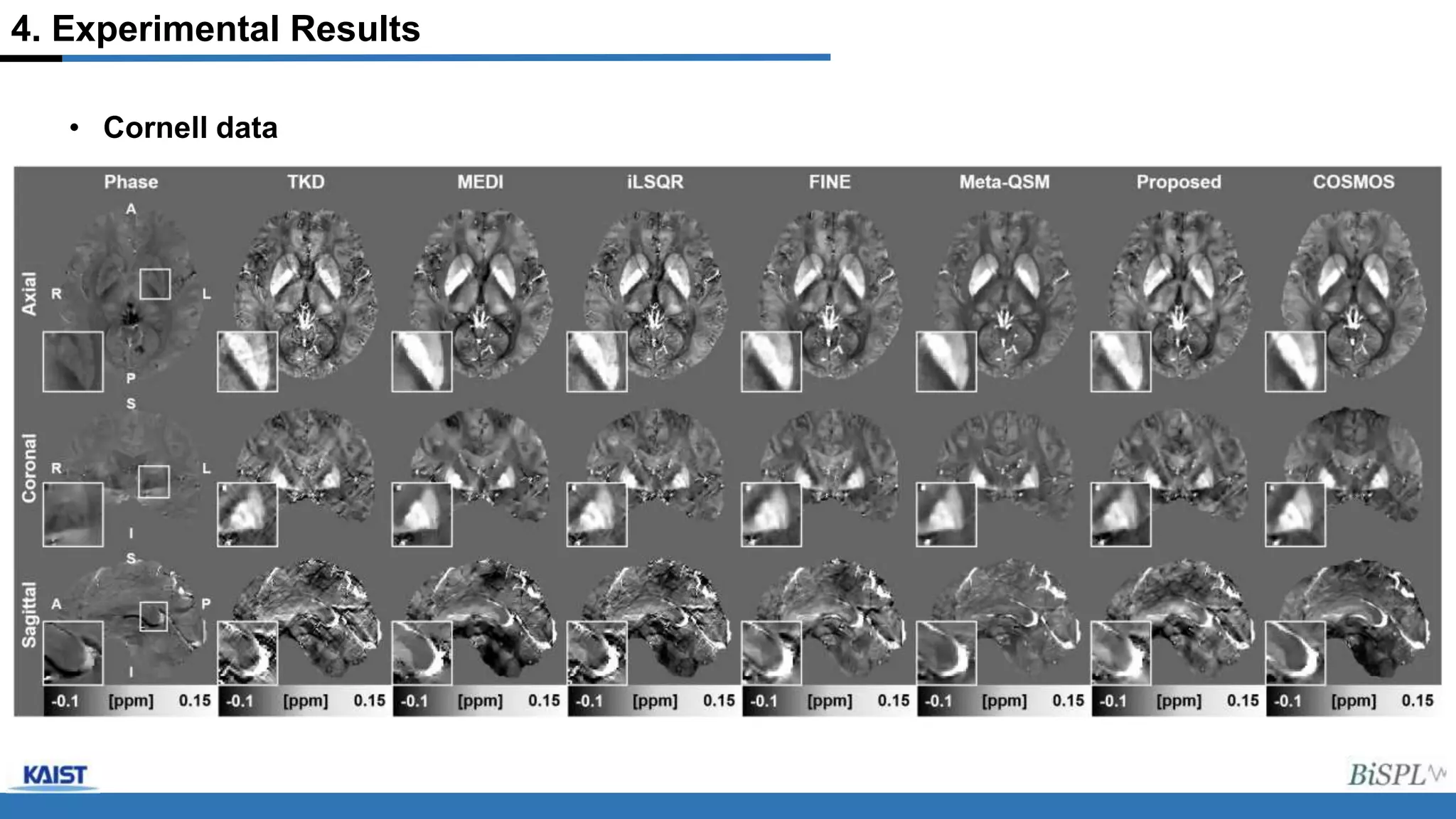 Unsupervised resolution-agnostic quantitative susceptibility mapping using adaptive instance ...