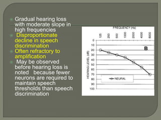 4. Presbycusis.pptx