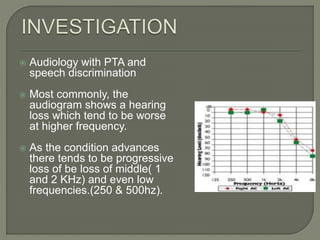 4. Presbycusis.pptx