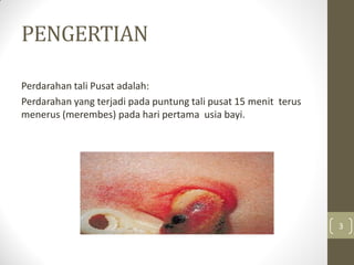 4. BAYI RESIKO TINGGI - PERDARAHAN, KEJANG, TETANUS OK.pdf