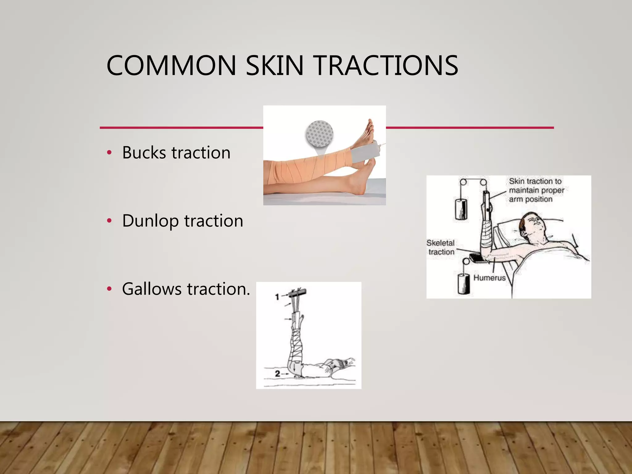 TRACTION,SPLINTS AND PLASTER OF PARIS | PPTX