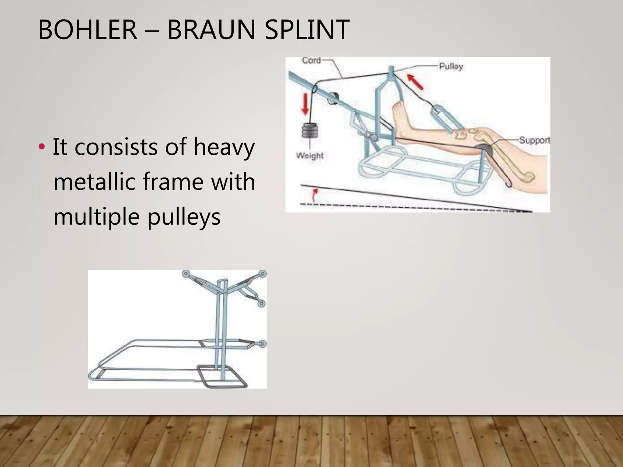 TRACTION,SPLINTS AND PLASTER OF PARIS | PPTX