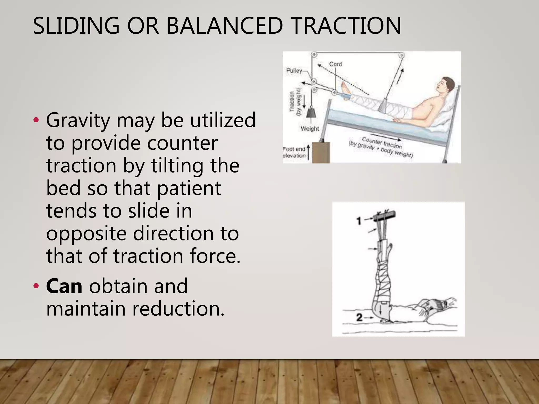 TRACTION,SPLINTS AND PLASTER OF PARIS | PPTX