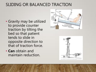 TRACTION,SPLINTS AND PLASTER OF PARIS | PPTX