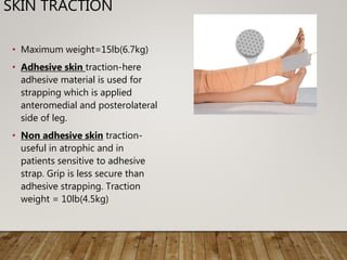 TRACTION,SPLINTS AND PLASTER OF PARIS | PPTX