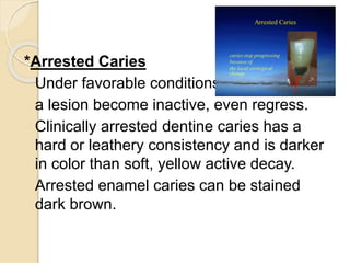4.DISEASE OF HARD TISSUES OF TEETH.pptx