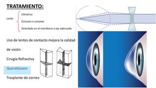 4.OPTICA Y REFRACCION.pptx