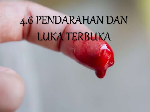 4.6 PENDARAHAN DAN LUKA TERBUKA.pptx
