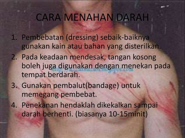 4.6 PENDARAHAN DAN LUKA TERBUKA.pptx