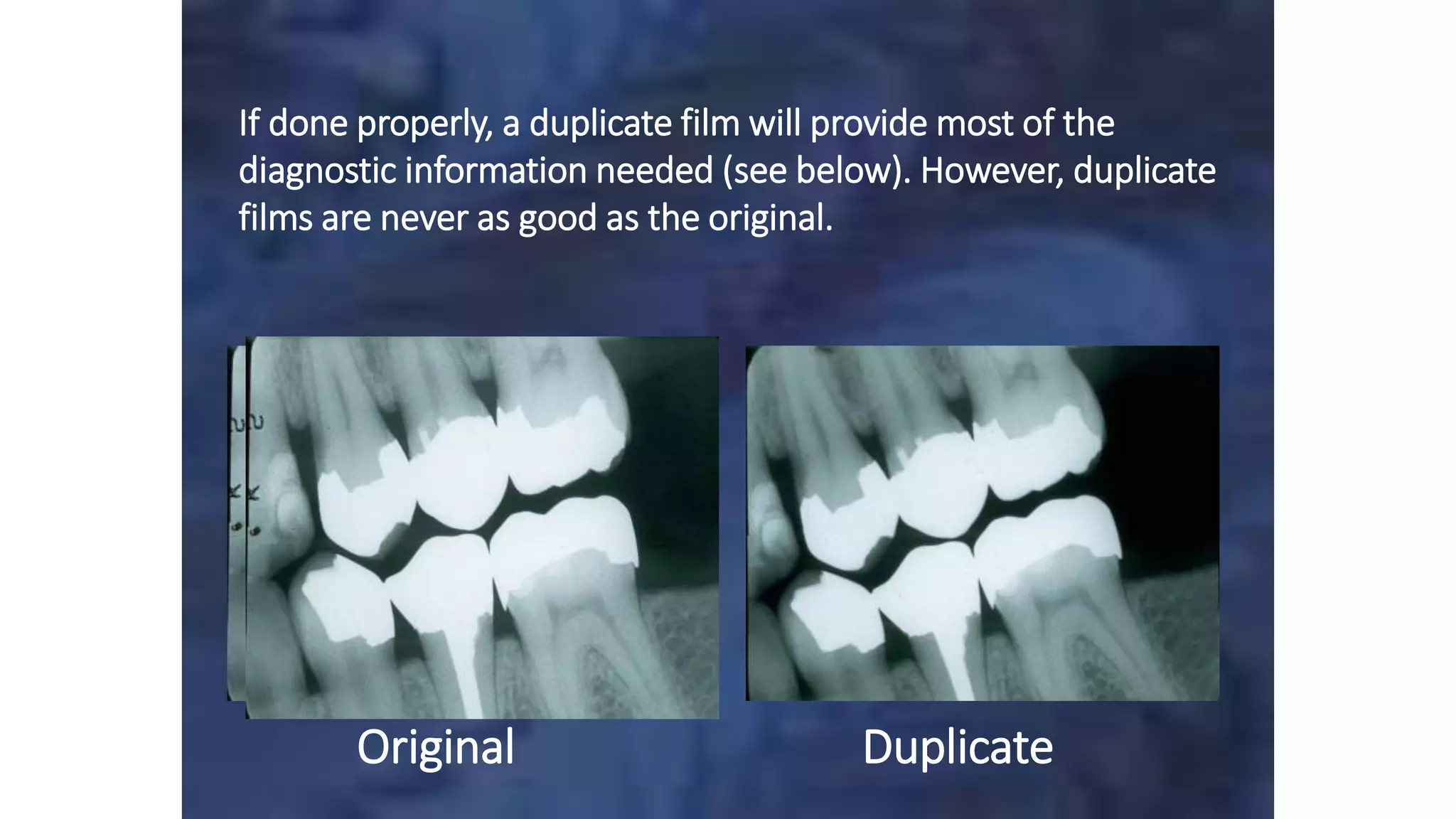 4. Dental X-Ray Film And Film Processing.pptx | Dental Health ...