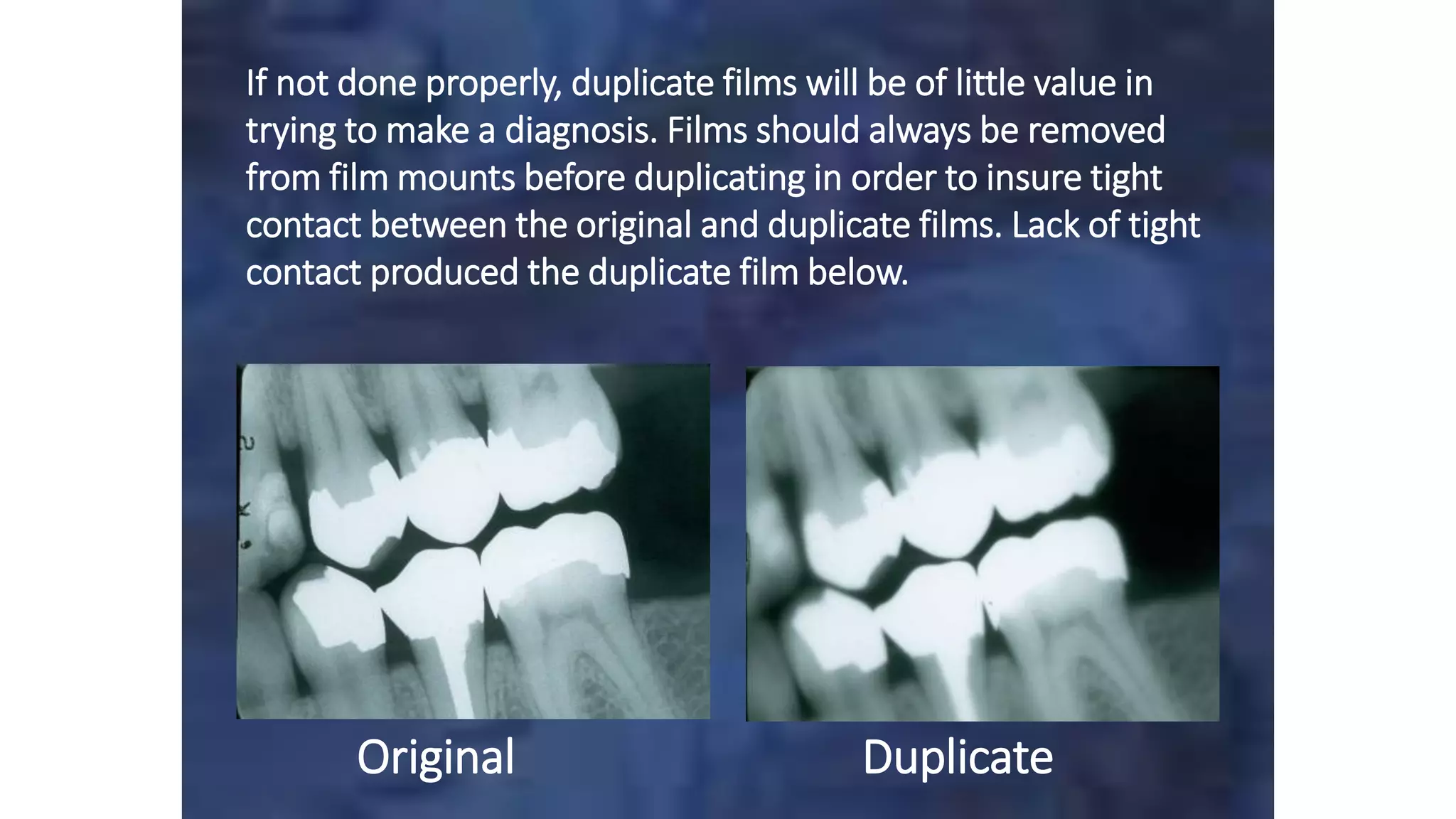 4. Dental X-Ray Film And Film Processing.pptx