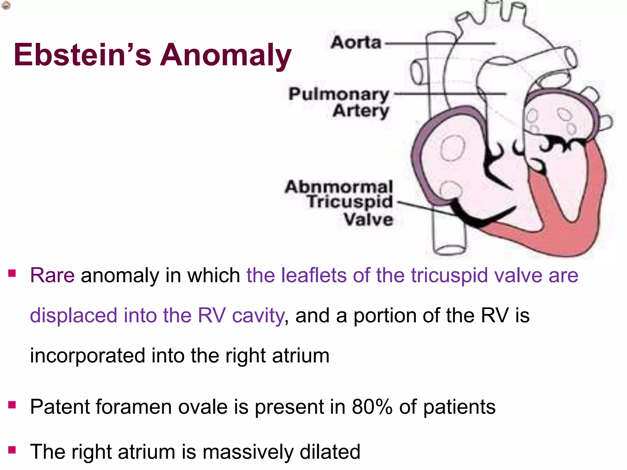 4. Heart-Lecture-IV Congenital heart disease.pptx