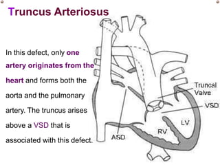 4. Heart-Lecture-IV Congenital heart disease.pptx