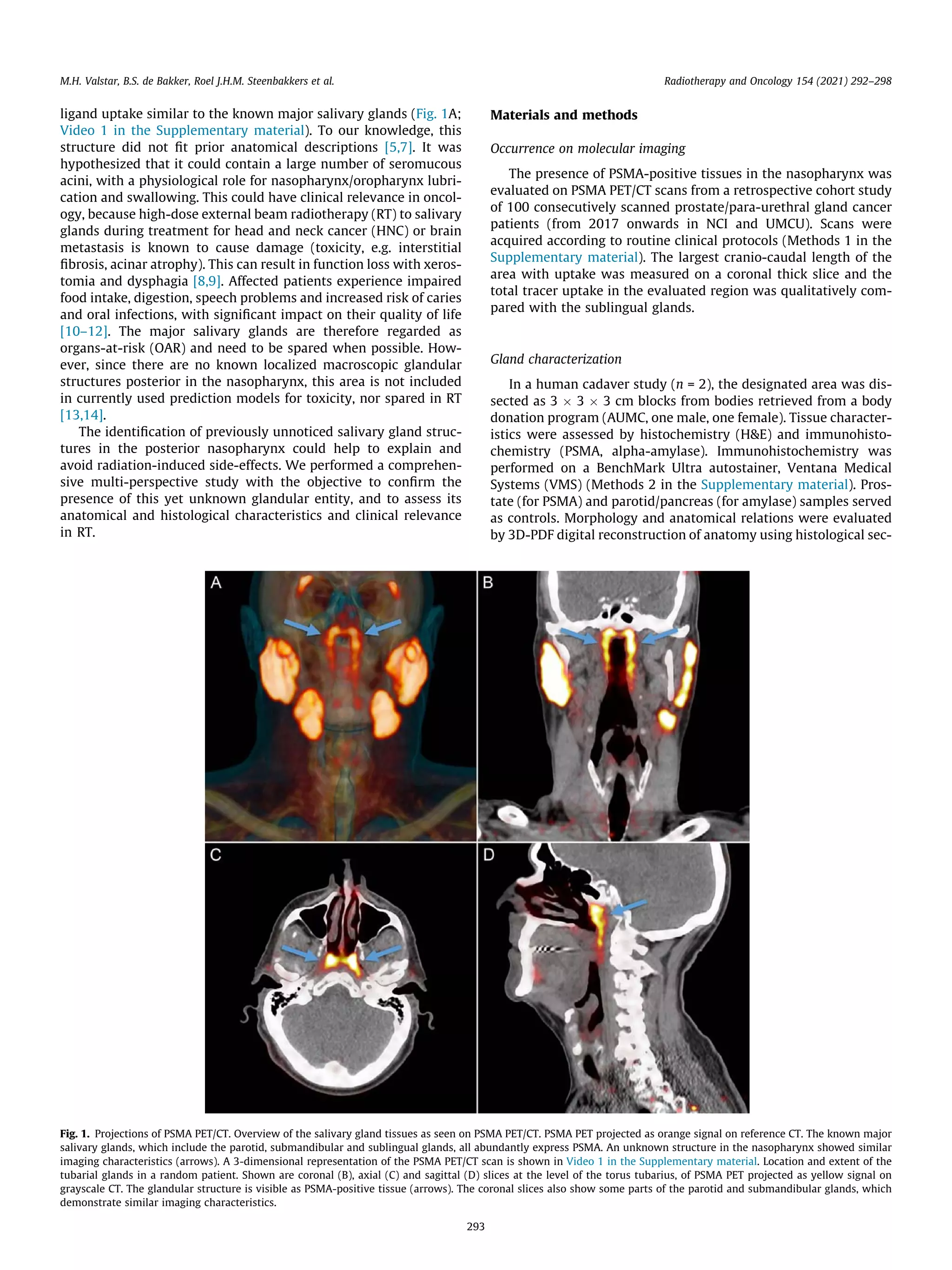 4.- The tubarial salivary glands. A potential new organ at risk for radiotherapy.pdf