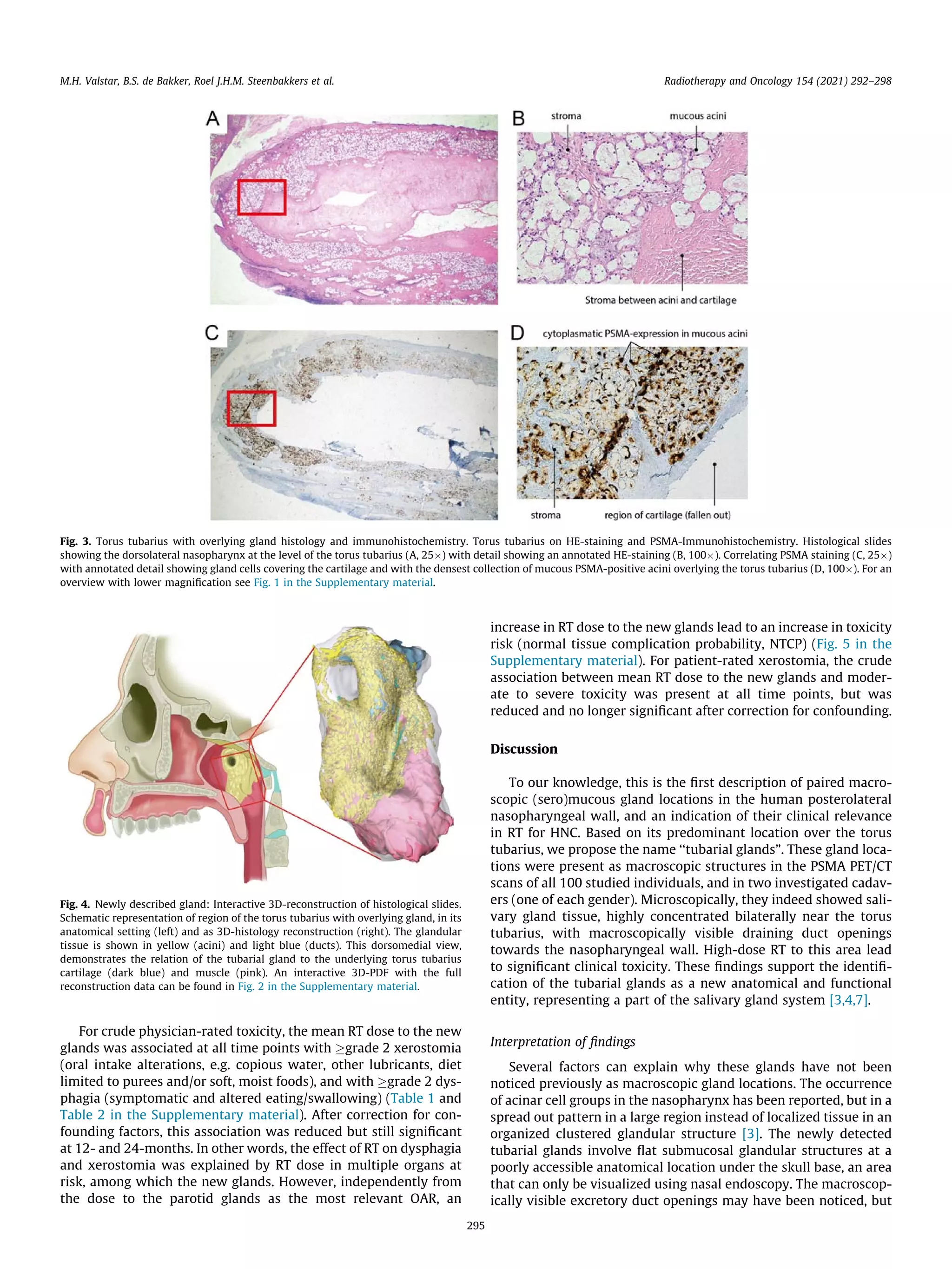 4.- The tubarial salivary glands. A potential new organ at risk for radiotherapy.pdf