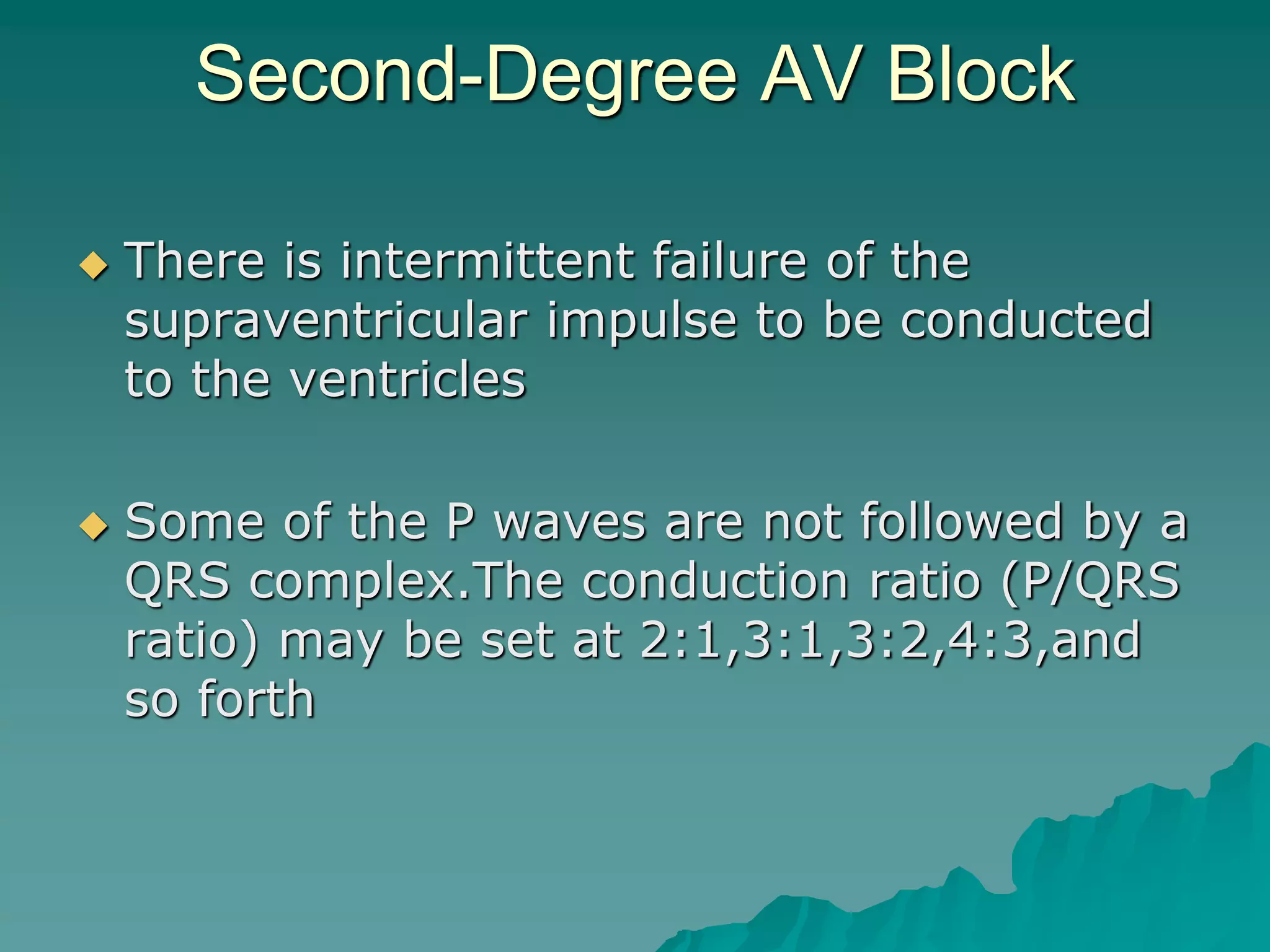 4. Cardiac conduction disturbances ppt (1).pdf