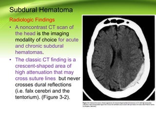 4. NeuroRadiology 1 - Neurologic imaging.pptx