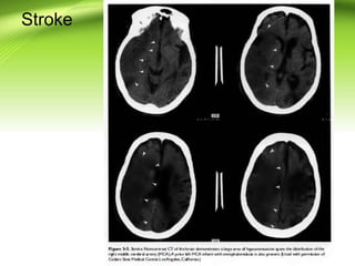 4. NeuroRadiology 1 - Neurologic imaging.pptx