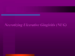 4.acute gingival infections.ppt