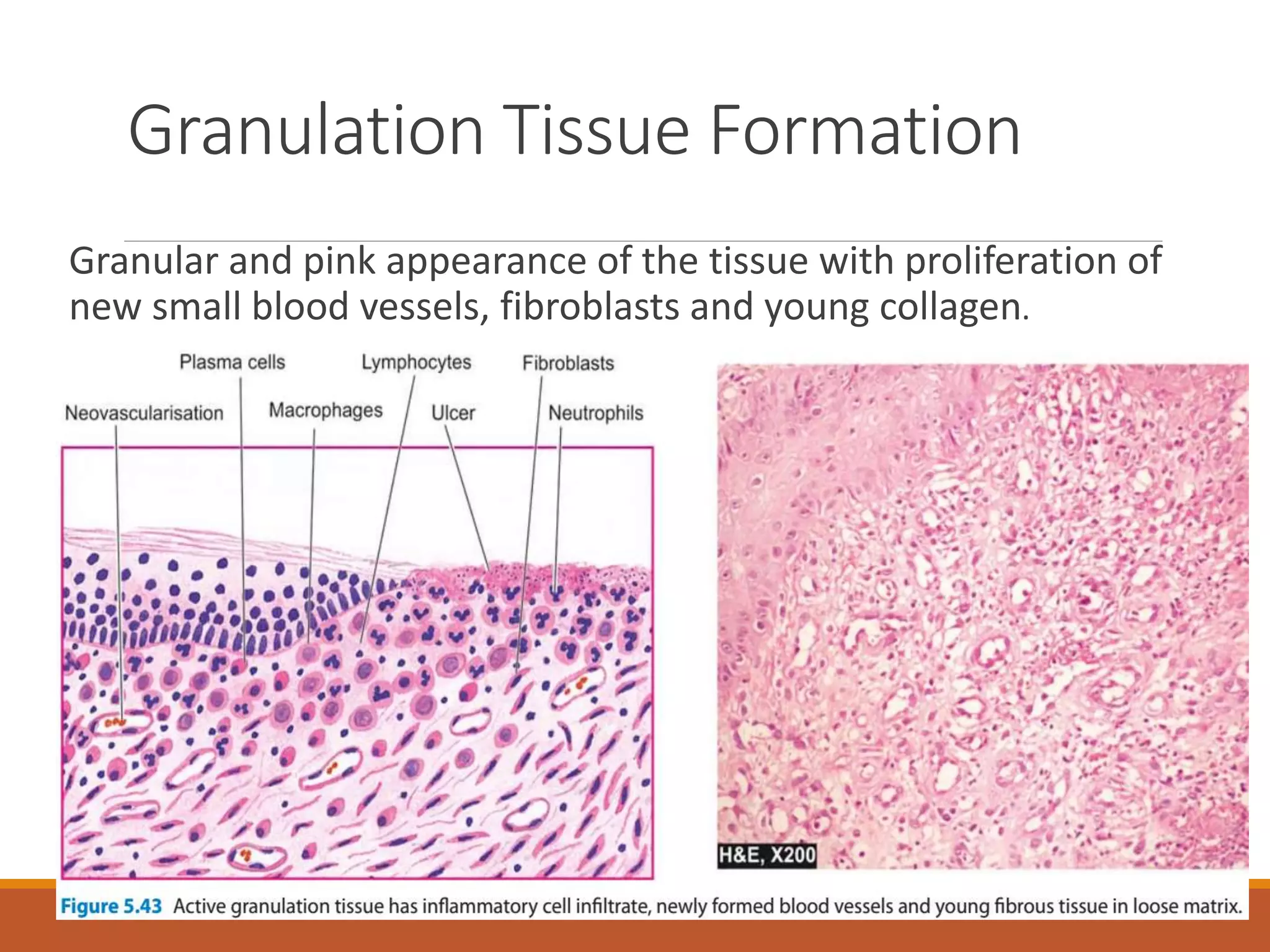 4.Wound Healing.pptx