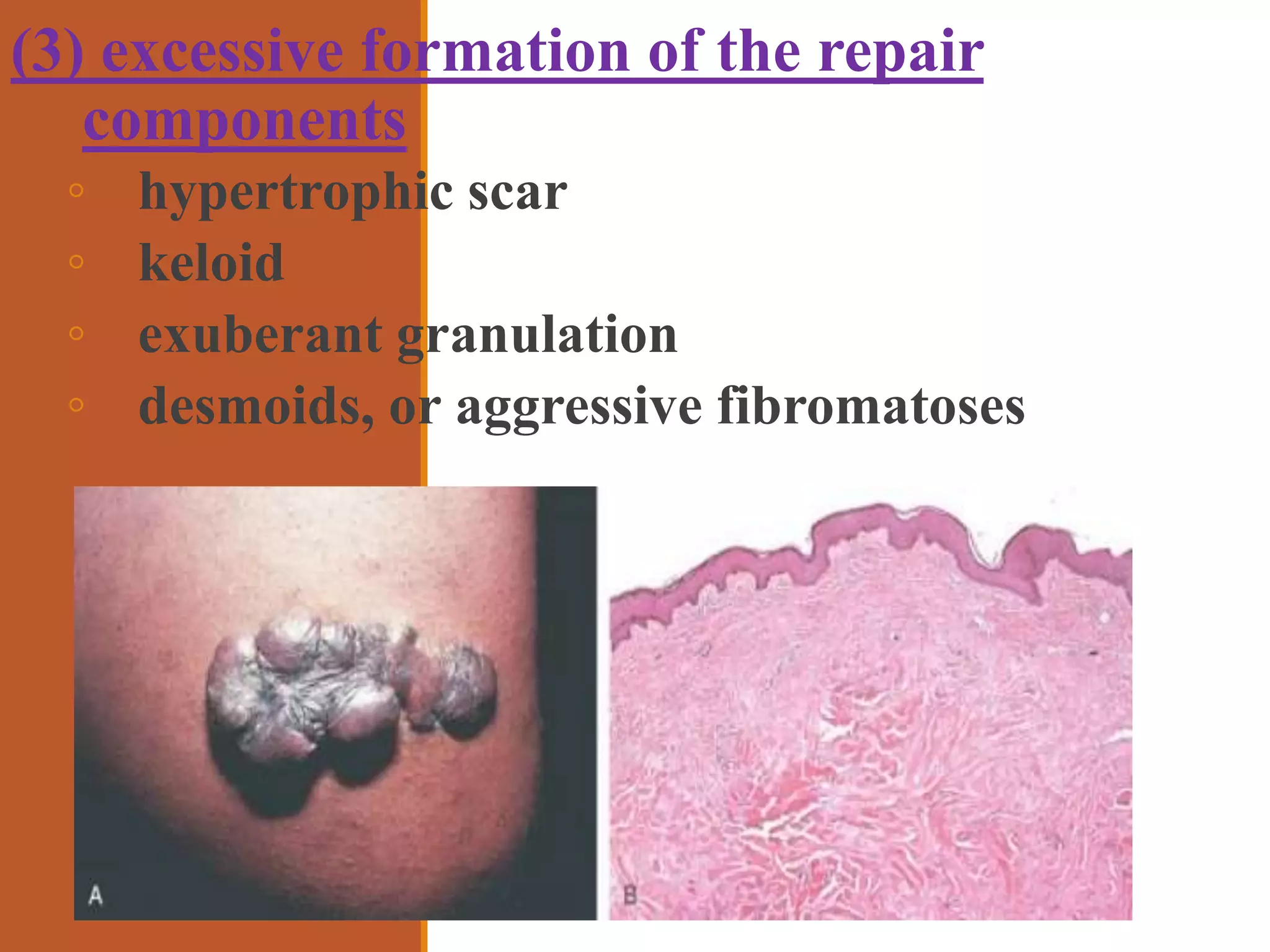 4.Wound Healing.pptx