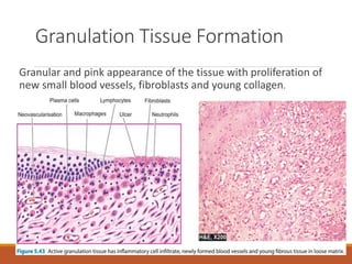 4.Wound Healing.pptx