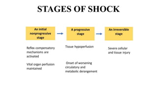 4. shock .pptx