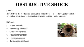 4. shock .pptx