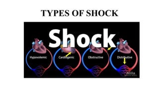4. shock .pptx