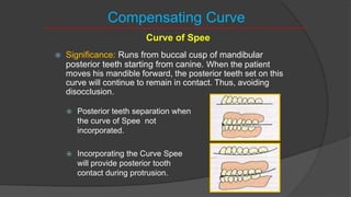 Compensating Curves.pptx