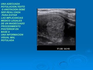 4.-OPTIMIZACION DEL ULTRASONIDO-CLASE CORTA IDEAL.pdf