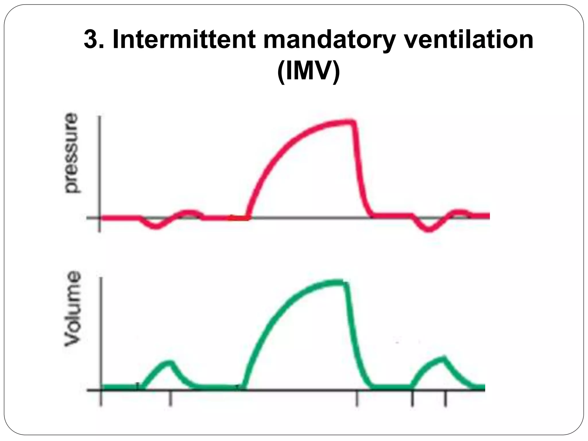 4.2-Mechanical-Ventilation-Part-II2.ppt