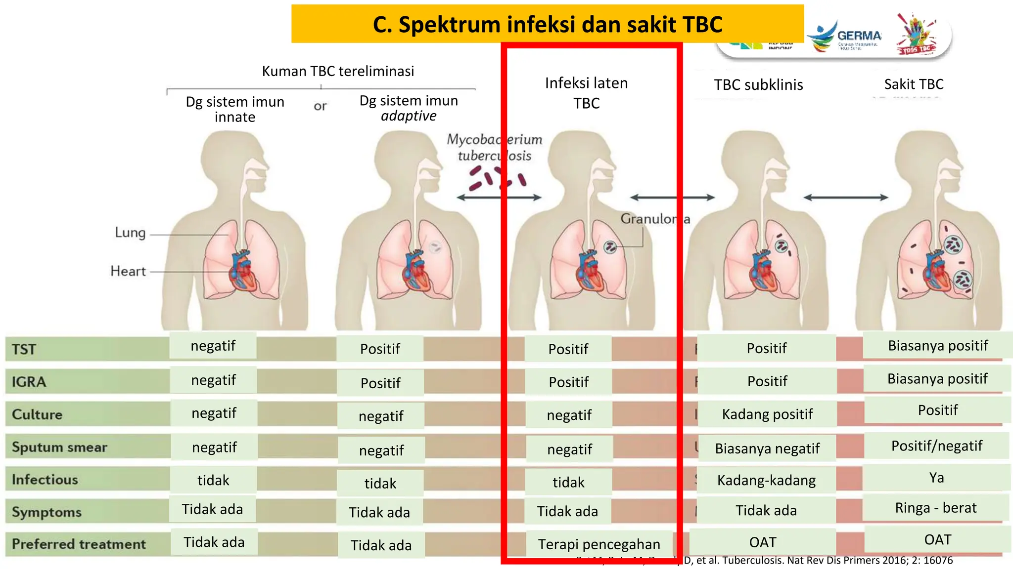 4. Diagnosis TBC pada Dewasa OK.pptx