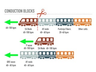 4. Impulse Abnormality.pdf