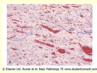 4. wound Healing.ppt