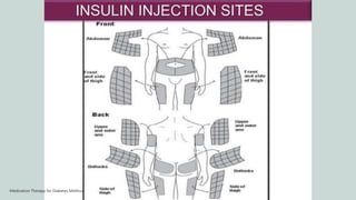 4. Medication therapy for diabetes management.pptx | Physical Therapy ...