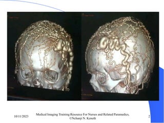 4. SRN 300 Skull Radiography and Pathologies.pdf