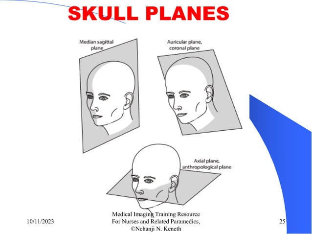4. SRN 300 Skull Radiography and Pathologies.pdf