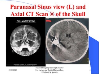 4. SRN 300 Skull Radiography and Pathologies.pdf