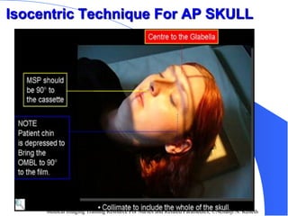 4. SRN 300 Skull Radiography and Pathologies.pdf
