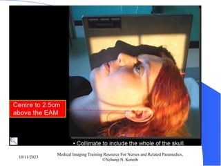 4. SRN 300 Skull Radiography and Pathologies.pdf