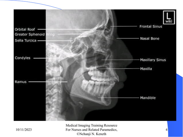 4. SRN 300 Skull Radiography and Pathologies.pdf