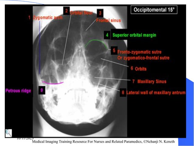 4. SRN 300 Skull Radiography and Pathologies.pdf