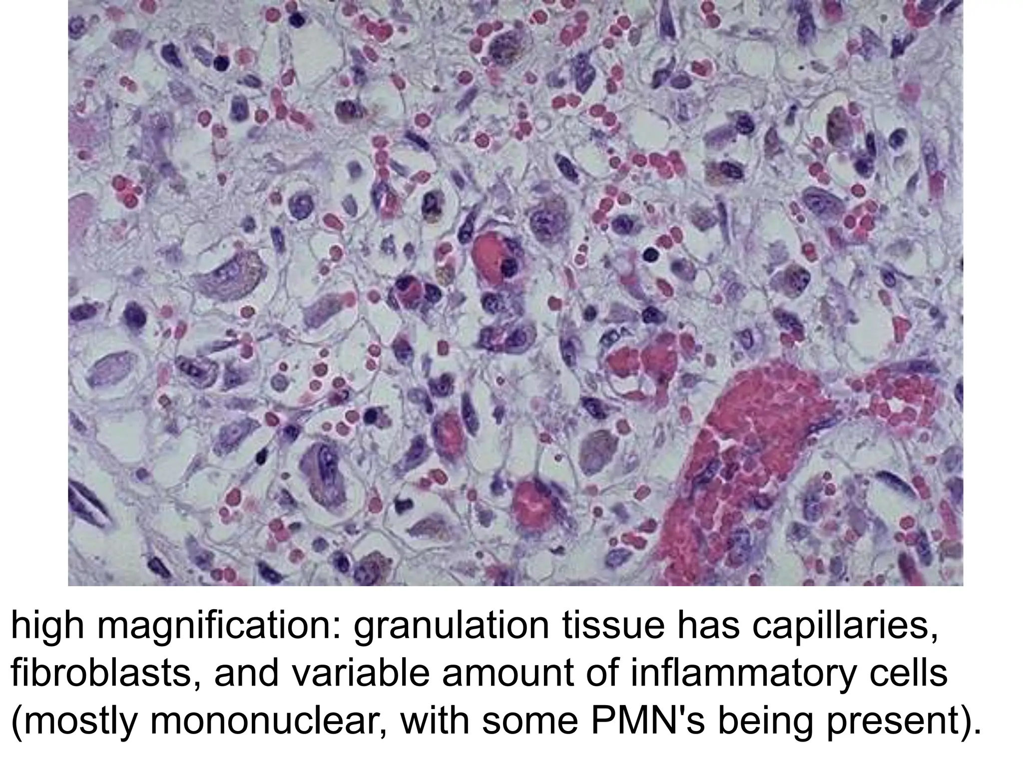 4. chronic inflammation.pptx