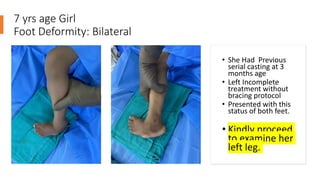 Mock Examination short case Club Foot.pptx