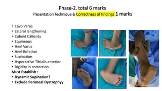 Mock Examination short case Club Foot.pptx