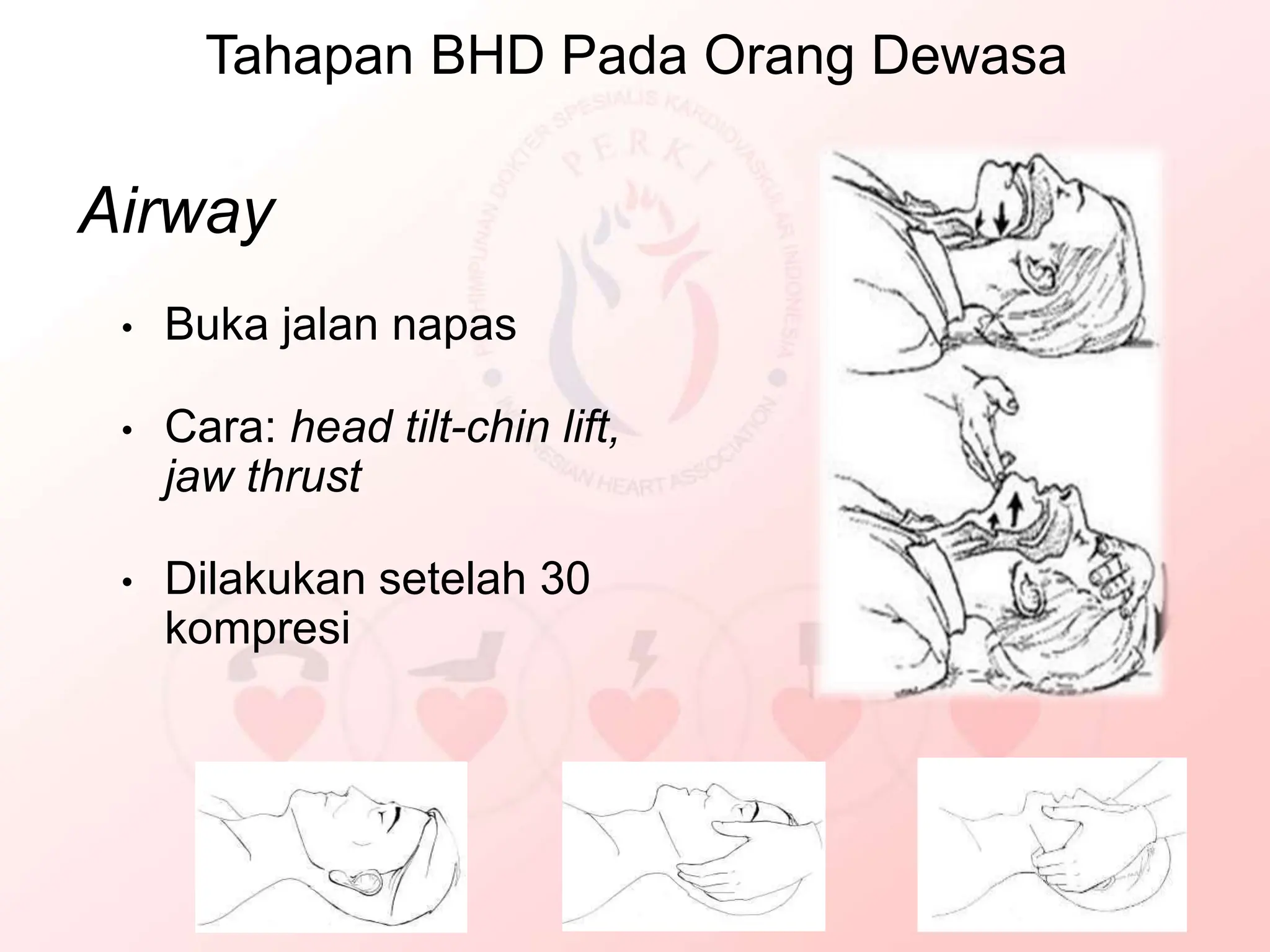 Bantuan Hidup Dasar (Basic cardiac life support)) | PPTX